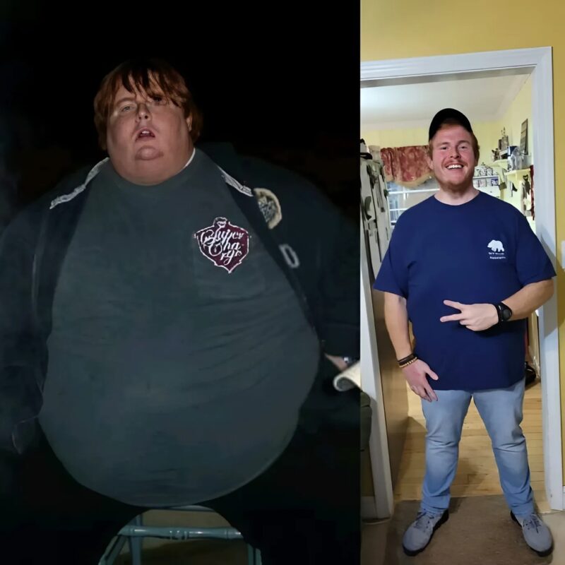 Incredible Transformation: How a Man Lost 440 Pounds